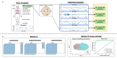 Diagnosis Of Parkinsons Disease Using Eeg Signals And Machine Learning Techniques A