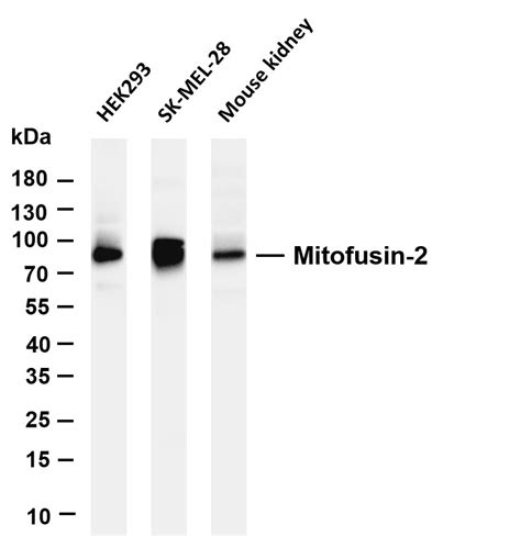 Mitofusin 2 Rabbit Monoclonal Antibody Full Moon Biosystems