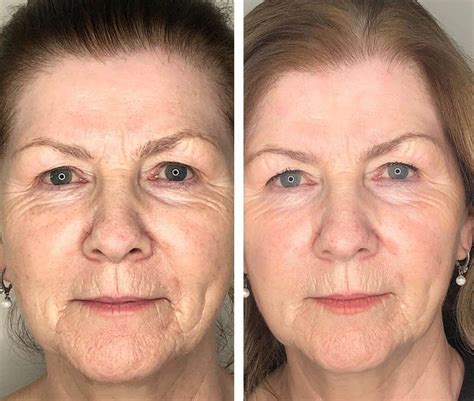 Prohfilo London Derma Clinic