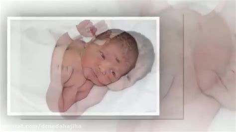 جراحی زایمان سزارین دکتر ندا حاجیها تماشا