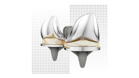 Total Knee Arthroplasty Using The Attune™ Knee System Jandj Medtech