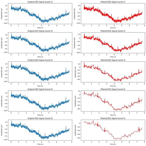 基于自适应阈值小波分解的脑电信号多尺度降噪与特征增强算法（python） 知乎