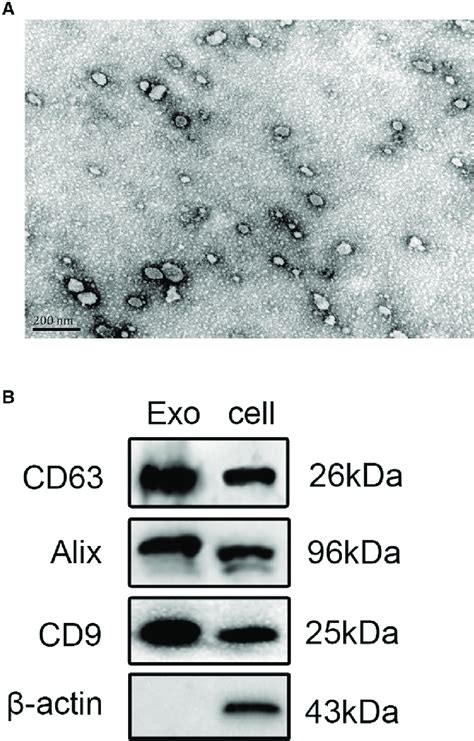 Characterization Of Microglia Derived Exosomes A Transmission Download Scientific Diagram