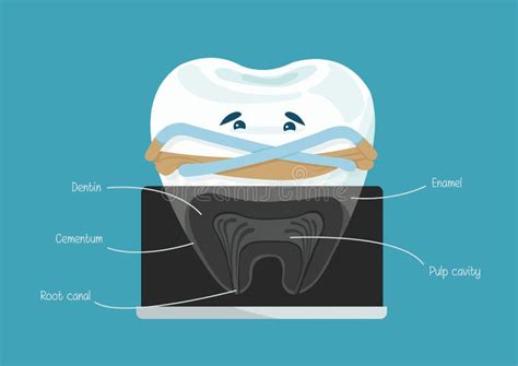 Root Canal Cartoon Stock Illustrations 413 Root Canal Cartoon Stock