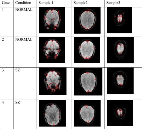 Fast Feature Point Detection Result Download Scientific Diagram