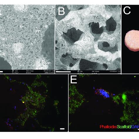 Hdpc Seeded E10011kβ Tcp Scaffolds Ab Sem Imaging Demonstrates Download Scientific