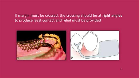 Components Of Rpd And Major Connectors Dr Shuchi Jain Pptx