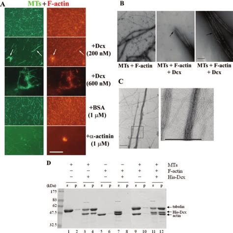 Co Localization Of Dcx With F Actin A Cos 7 Cells Expressing Gfp Dcx