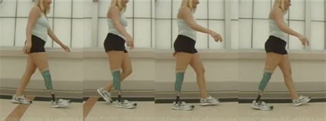 Transtibial Gait Deviations Flashcards Quizlet
