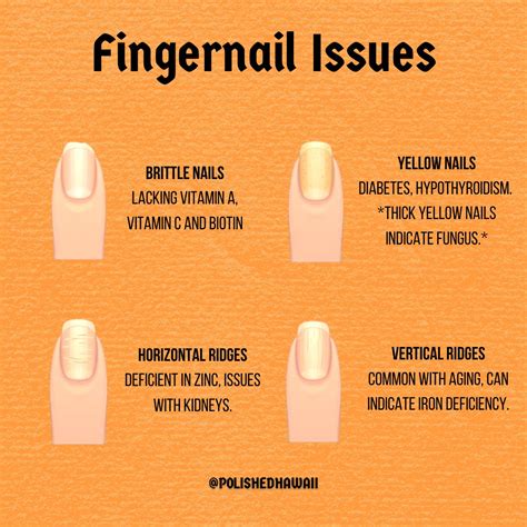 Horizontal Ridges On Fingernails Deficiency What Causes White Milk