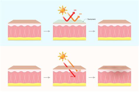 자외선 차단제와 비 자외선 차단제 피부의 차이 Uva 및 Uvb 광선으로부터 피부를 보호합니다 흑색종에 대한 스톡 벡터 아트 및 기타 이미지 Istock