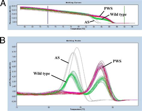 Quantitative And Qualitative Analyses Of The Snrpn Gene Using Real Time