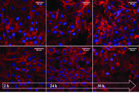 Actin Fibers Red Rhodamine Phalloidin Probe And Nuclei Blue Dapi Download Scientific