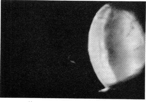 Figure 10 From Lamellar Keratoplasty Using Full Thickness Donor Material Semantic Scholar