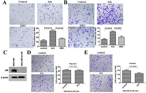 Figure 2 From Acetylcholine Acts On Androgen Receptor To Promote The