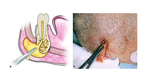эрүү нүүр орчмын нэвчээс Pdf