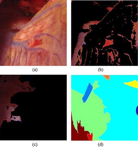 Vessel Segmentation Results From Some General Segmentation Algorithms Download Scientific
