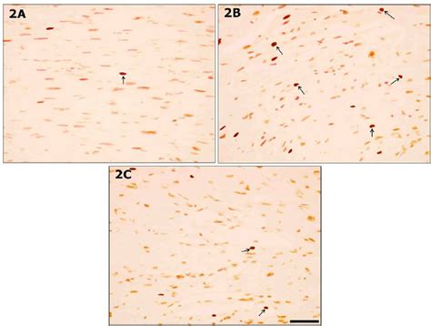 Tunel Detection Of Apoptotic Cells In Control A Dox Treated B And