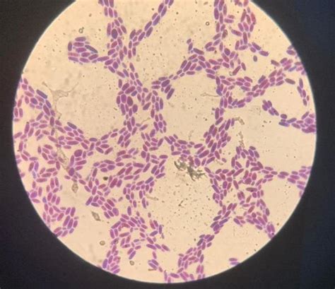Microscopic Morphology Of Isolate A Saccharomyces Cerevisiae
