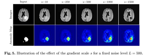 Diffusion Anomaly Detection Generative Ai From Start To Surrender