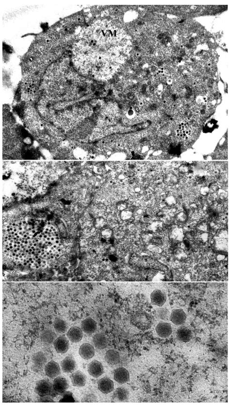 Electron Micrographs Of Infected Cell And Propagated Virus Particles