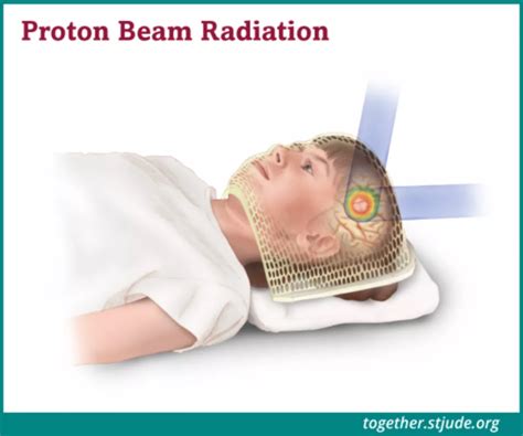 Proton Beam Radiation For Pediatric Cancer Patients Together By St Jude™