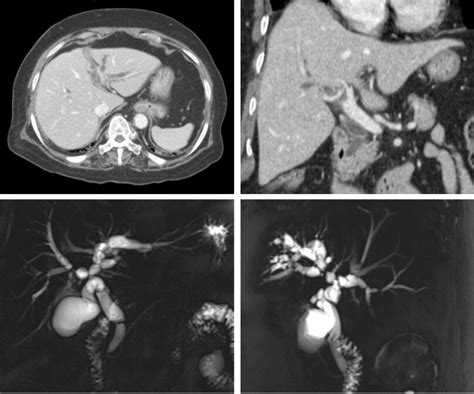 Initial Imaging Studies A B Abdominal Computed Tomography Shows