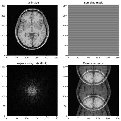 4 Cartesian Perodic Under Sampling Along Parallel Lines — Mri