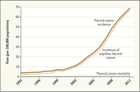 Thyroid
