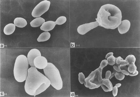 Effect Of Different Concentrations Of Lysozyme On C Albicans Bm20617
