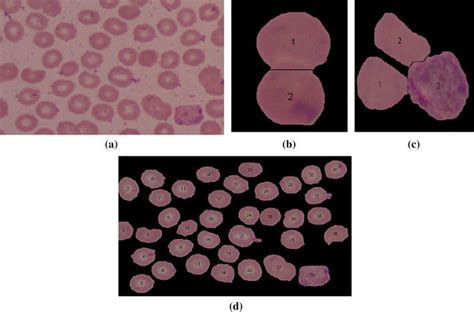 Segmentation Result A Original Image B Clump Of 2 Erythrocytes C