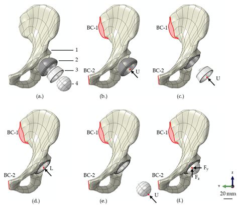 Types Of Acetabular Cups At Jasper Gunson Blog