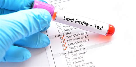 Cardiovascular Disease Prevention Diagnostics Mims Indonesia