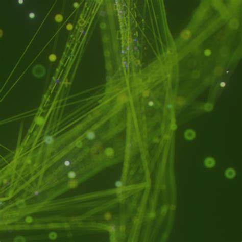 A Phase Ii Functional Clinical Assay For Cancer Precision Medicine