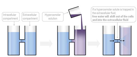 Hyperosmolar Hyponatremia Deranged Physiology