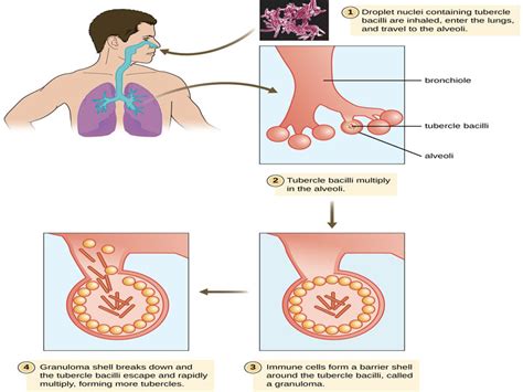 Doxycycline Side Effects Should Doxycycline Be Taken