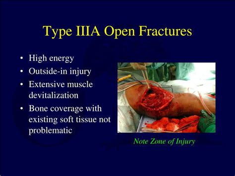 Ppt Fracture Classification Powerpoint Presentation Free Download