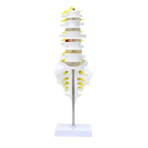 Life Size Lumbar Spine Model Lumbosacral Segment With A Herniated Disc Lyou Anatomy