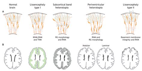 Development Neuronal Migration In The Cns During
