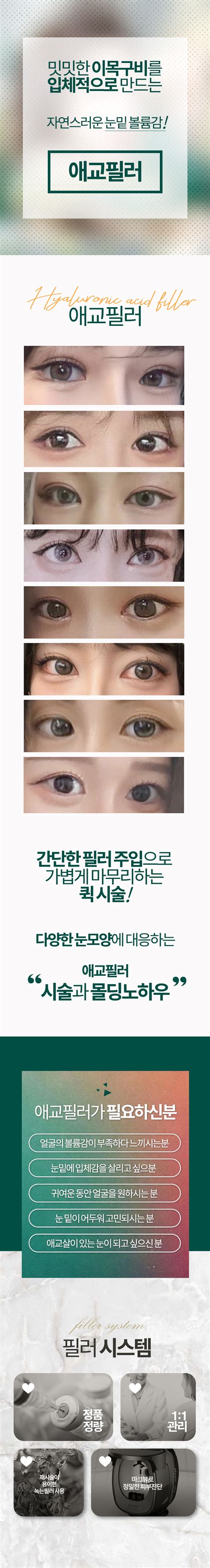 쌩얼의 완성은 애교필러 By 픽셀랩성형외과의원 강남언니 1등 성형수술and피부시술 정보앱