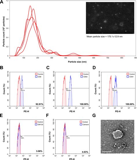 The Characterization Of A Evs A Particle Size Distribution Of A Evs