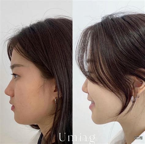 공제우 리그램 Chahyeon 레이어드c컬펌 보더펌 허그펌 윈드펌 중단발펌 중단발레이어드 중단발스타일 C컬펌 Instagram