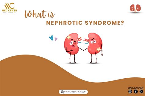 What Is Nephrotic Syndrome Causes Sign And Symptoms Med Crash