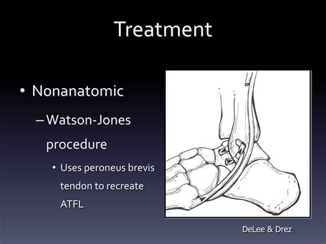 Ppt Ankle Injuries In The Athlete Powerpoint Presentation Free Download Id 2075617