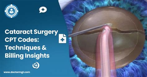 Cataract Surgery Cpt Codes Techniques And Billing Insights