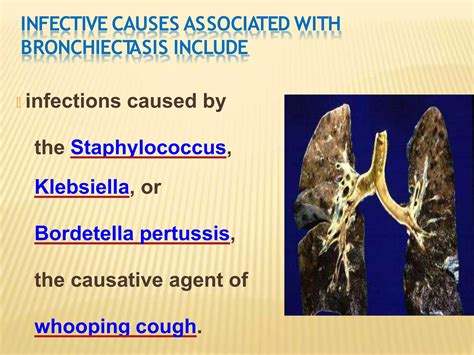 11bronchiectasispptx