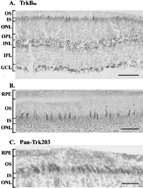 Figure 1 From Colocalization Of Trkb And Brain Derived Neurotrophic