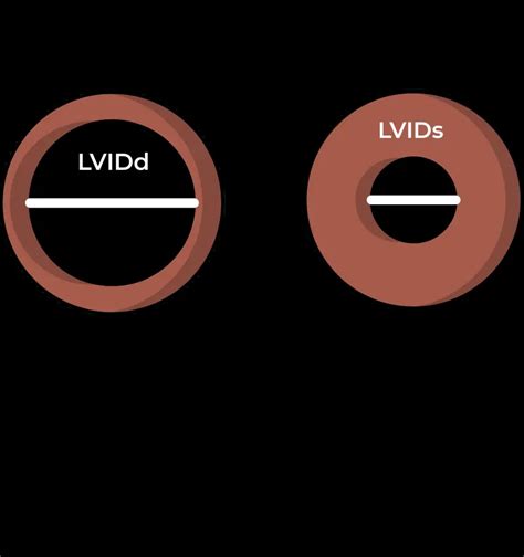 left ventricular stroke volume from left ventricular area