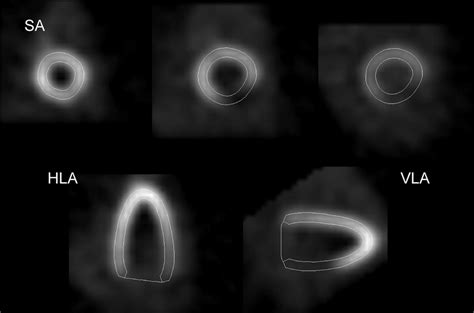 Example Of Phantom Images With Physical Defect Size Of 21 Results Of