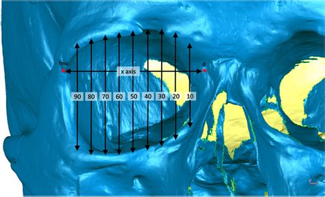 Orbital Measurements Deciles Download Scientific Diagram